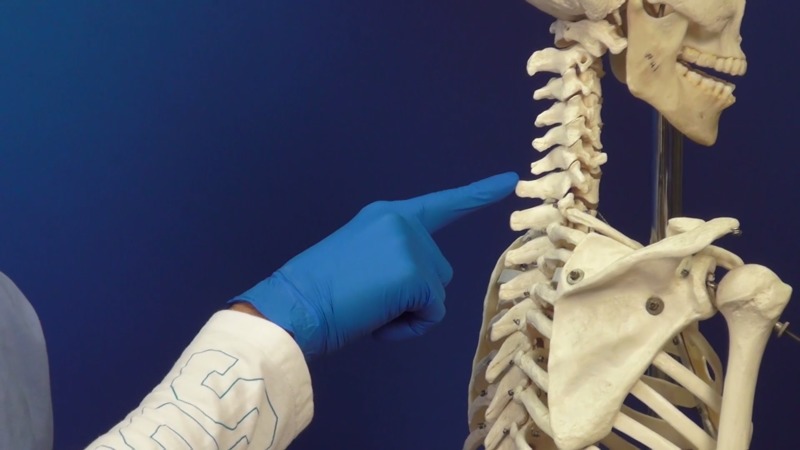 SFA - Superficial Back