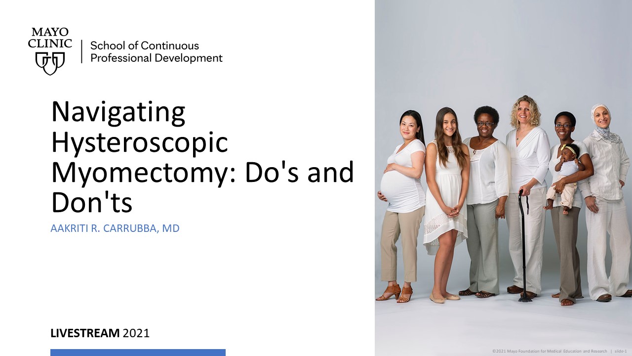 Navigating Hysteroscopic Myomectomy: Do's and Don'ts