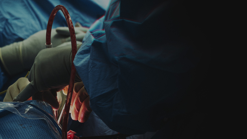 Frontal Orbital Advancement for Repair of Metopic Craniosynostosis