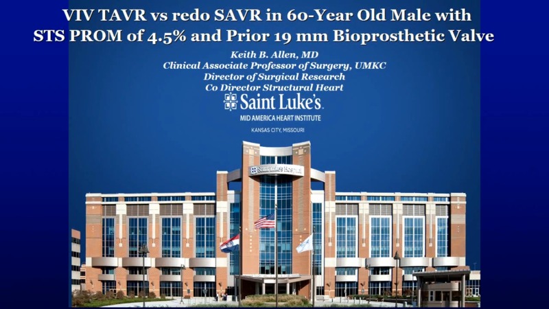 DEBATE: 60-Year-Old Man With STS PROM 4.5% and Prior 19 mm ...