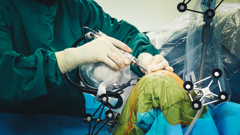 Robotic Right Colectomy