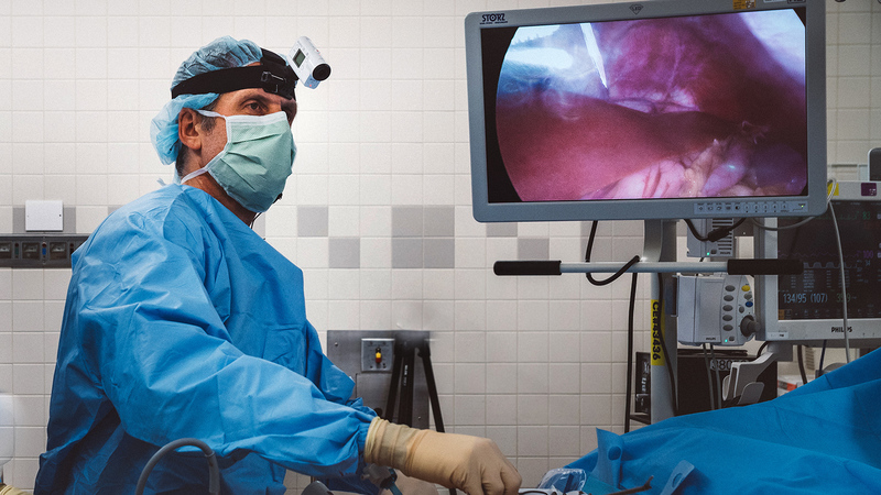 Spleen-Preserving Laparoscopic Distal Pancreatectomy