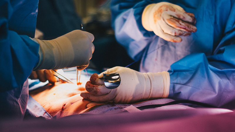 Open Inguinal Hernia Mesh Plug Removal and Repair