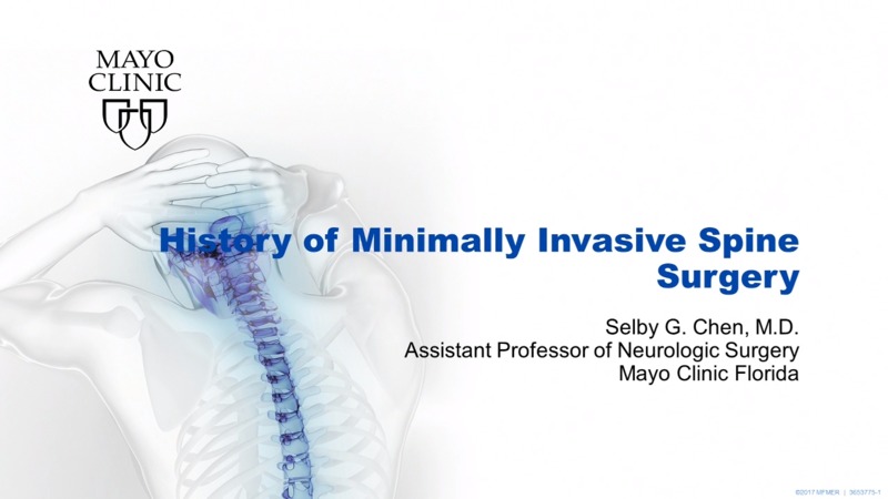 History of Minimally Invasive Spine (MIS) Surgery
