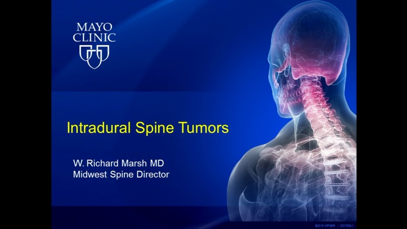 Diagnosis, Management and Outcome of Intradural Spinal Tumor