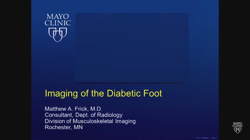 Imaging of the Diabetic Foot