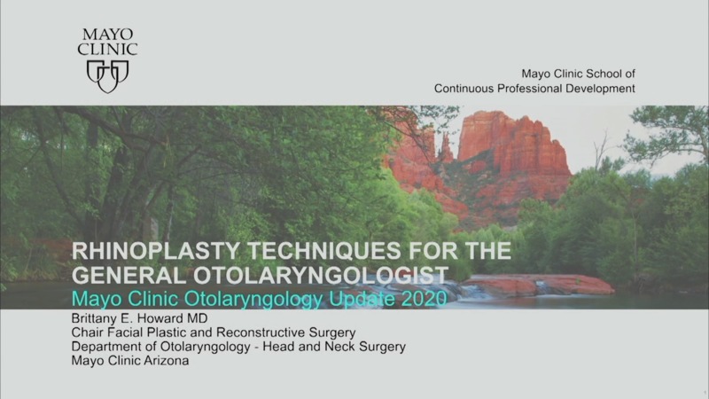 Open Rhinoplasty with Septoplasty and Rib Cartilage Graft