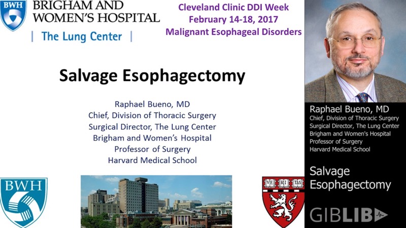 Esophageal Surgery