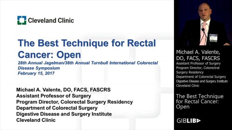 Rectal Cancer: The Best Technique for Rectal Cancer: Open