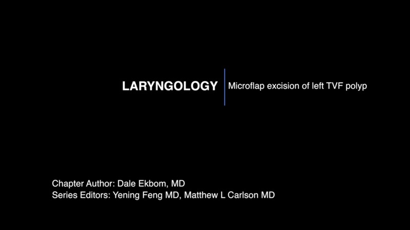 Microdirect Laryngoscopy with Microflap for Vocal Cord Cyst Excision