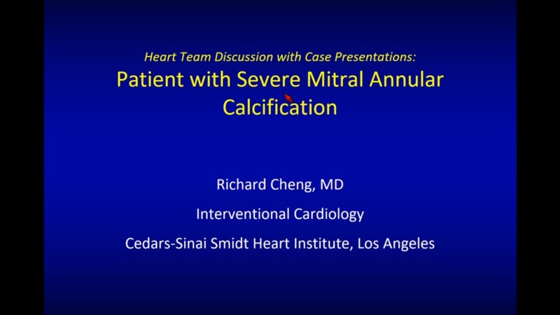 Heart Team Discussion With Case Presentations: How I Decide Between ...
