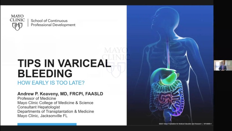 TIPS in Variceal Bleeding: How Early is Too Late?