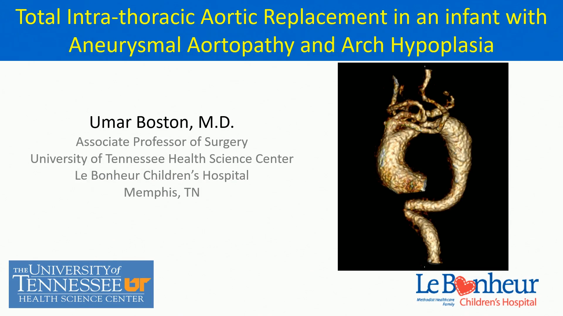 Total Intrathoracic Aortic Replacement in an Infant with Dilated ...