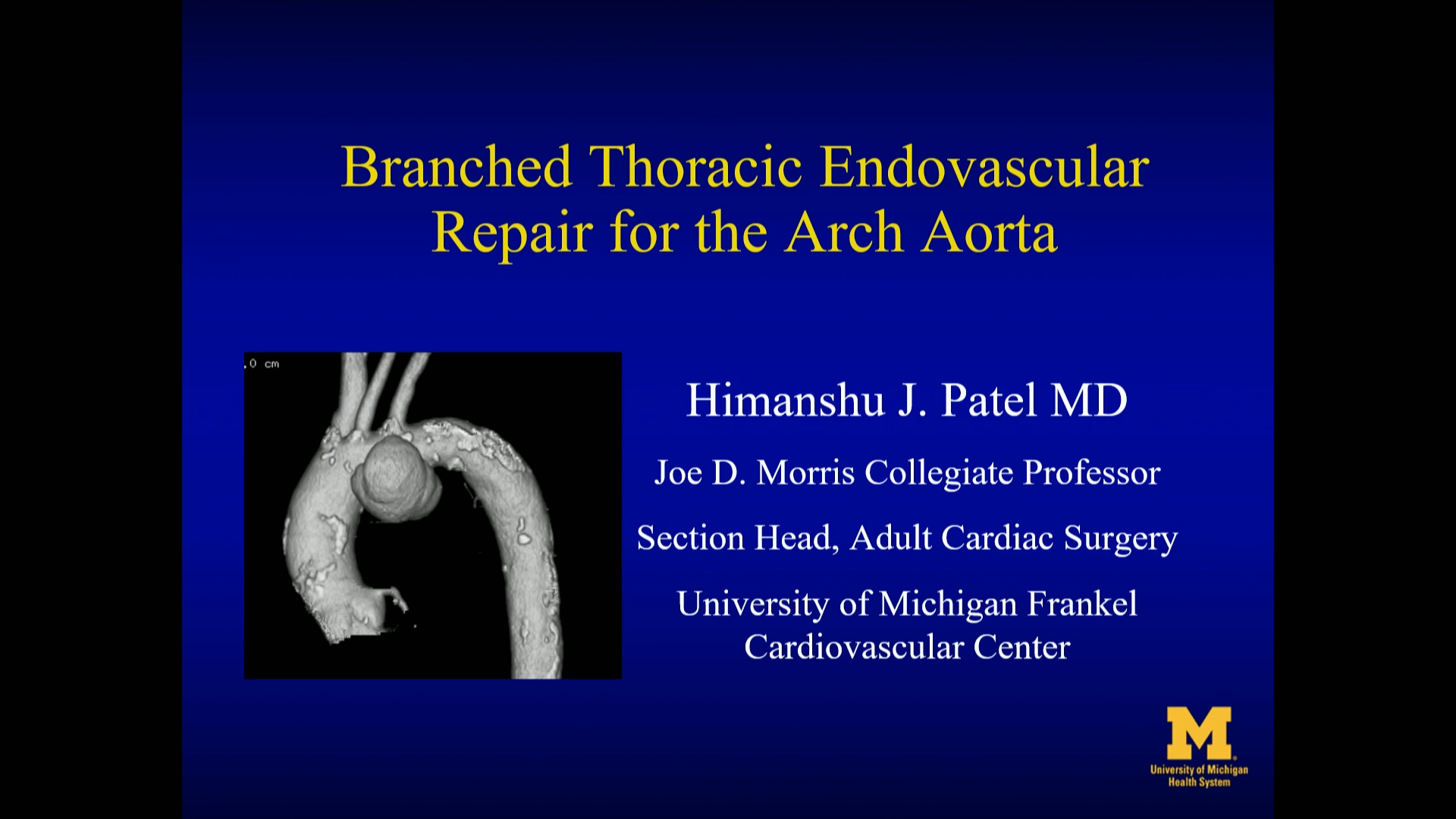 Branched Endograft Replacement for Aneurysmal Arch Disease