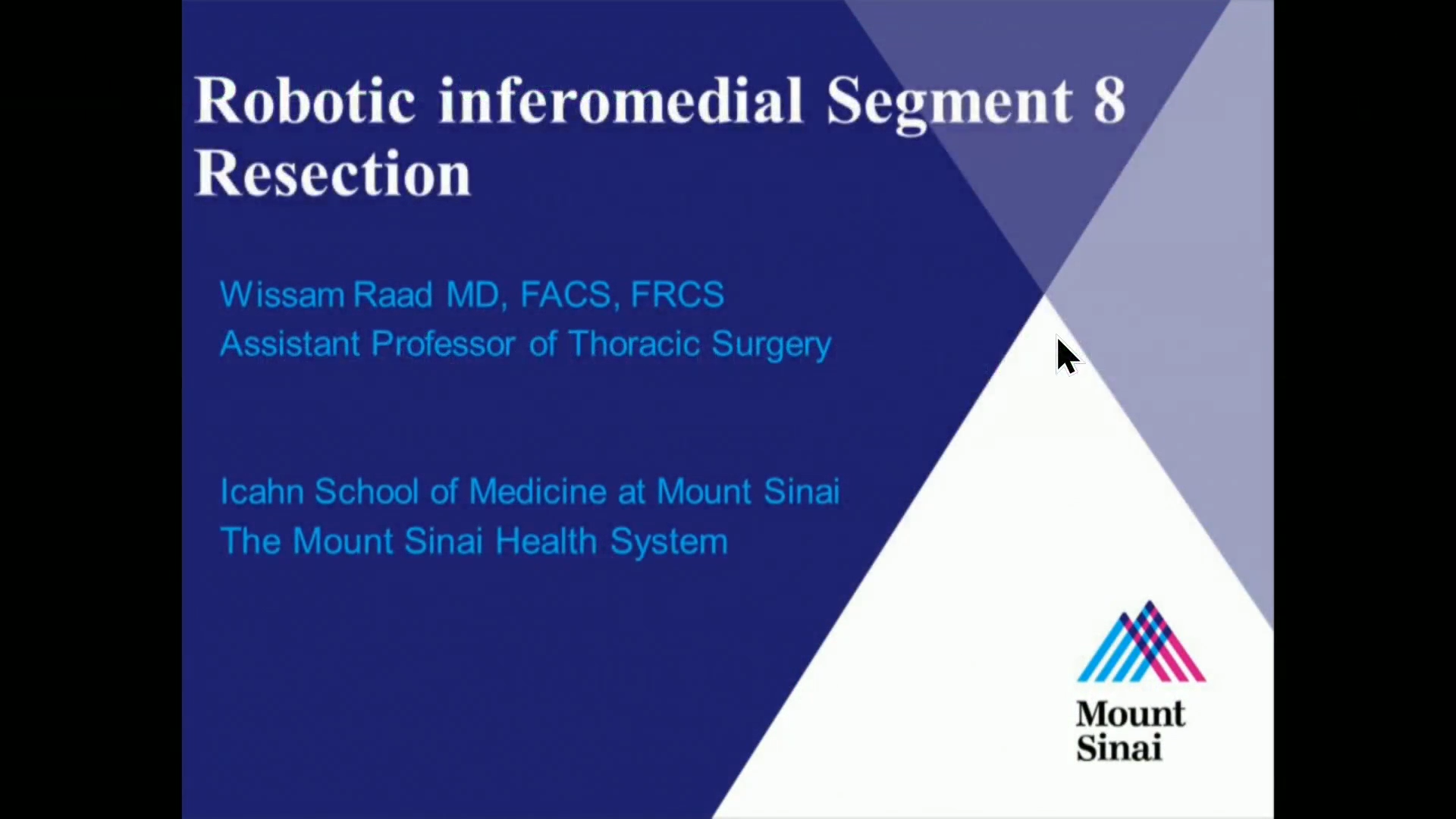 Robot-Assisted Left Inferomedial Segment 8 Resection