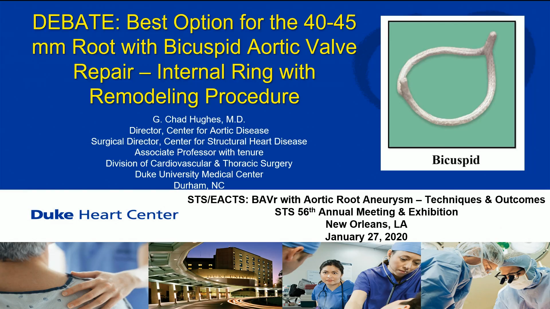 DEBATE: Best Option for the 40-45 mm Root with Bicuspid Aortic Valve ...