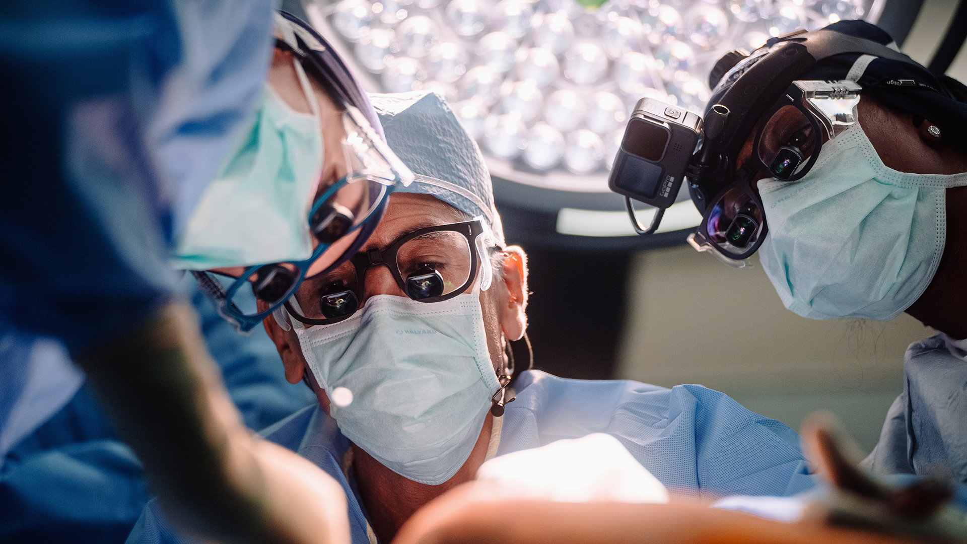 Femoral to Popliteal Bypass Graft with Saphenous Vein