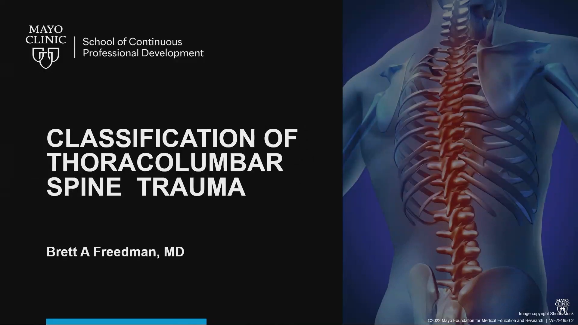Classification of Thoracolumbar Spine Trauma